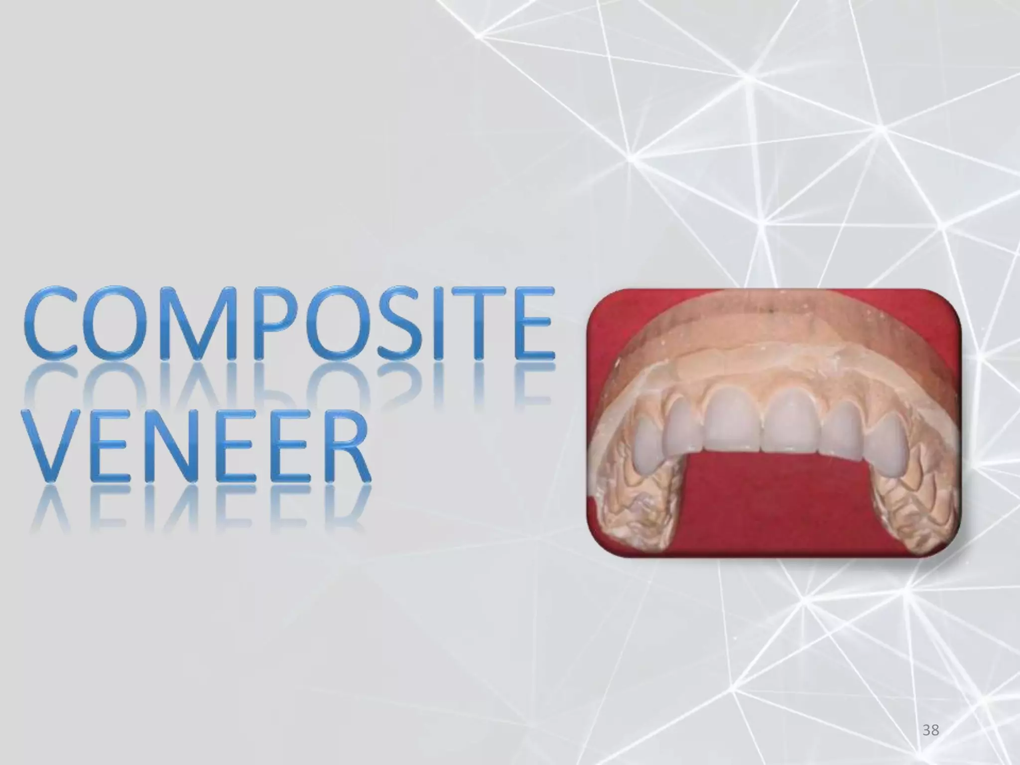 Indirect composite restorations | PPTX