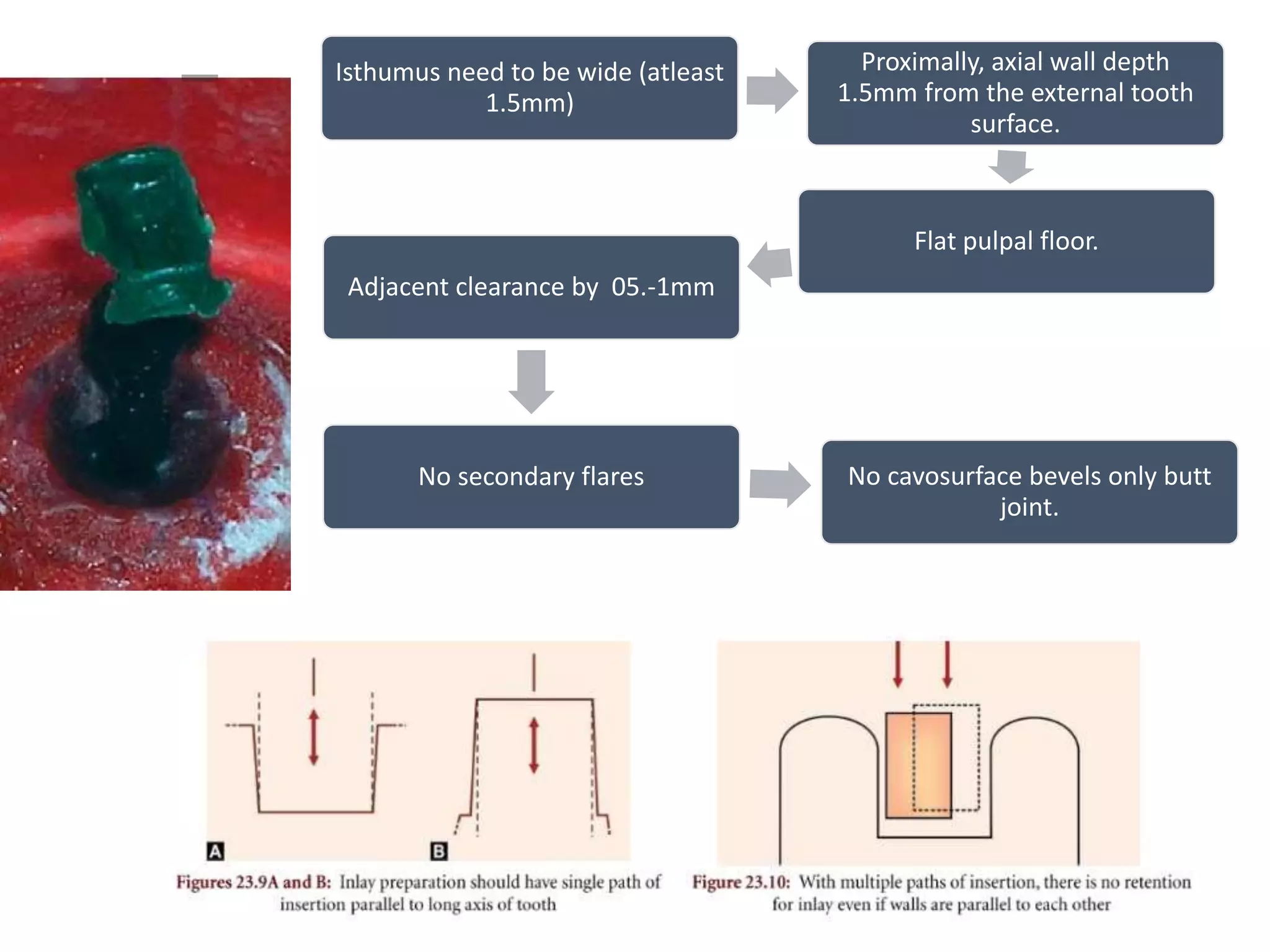 Indirect composite restorations | PPTX