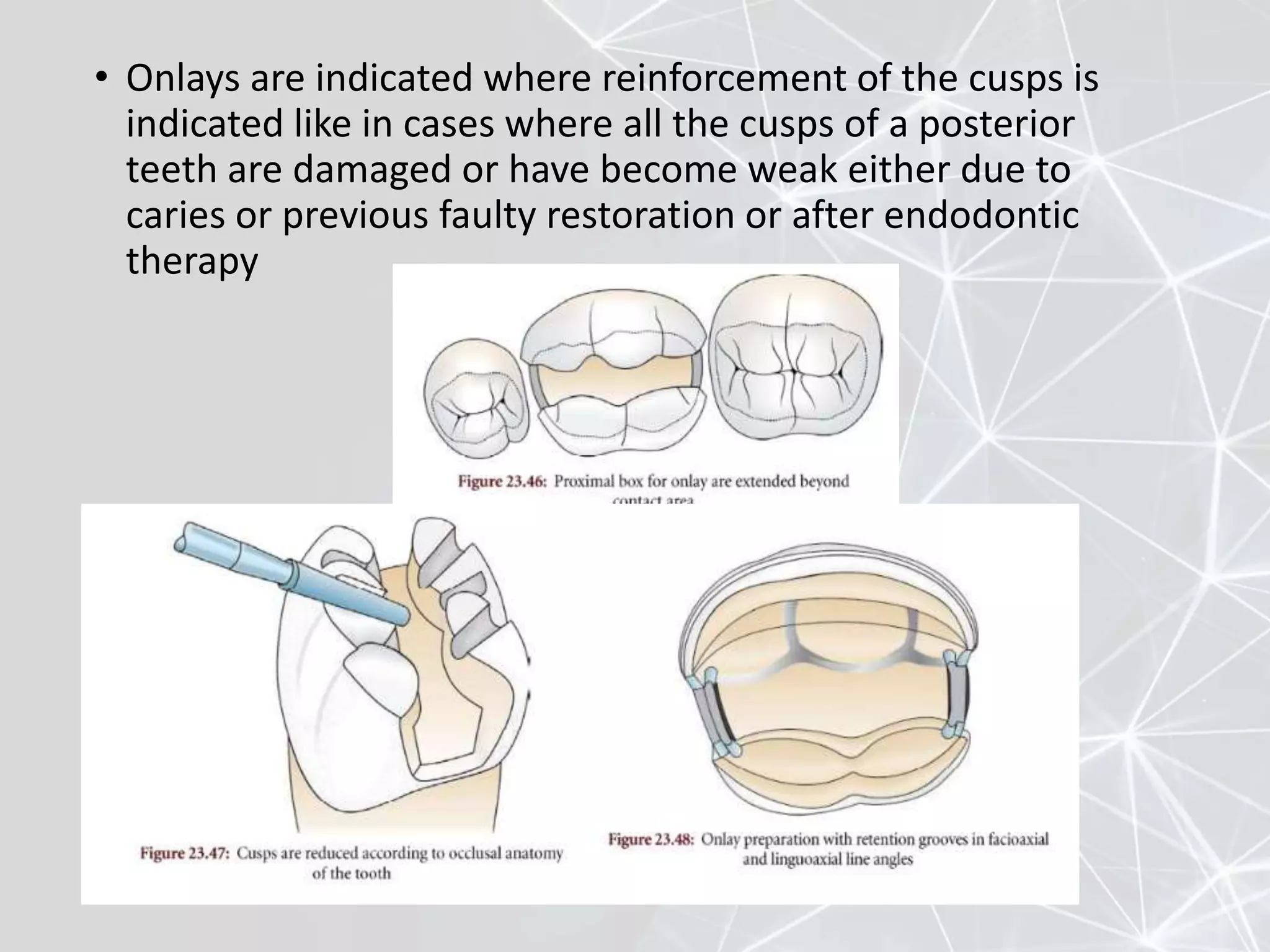 Indirect composite restorations | PPTX