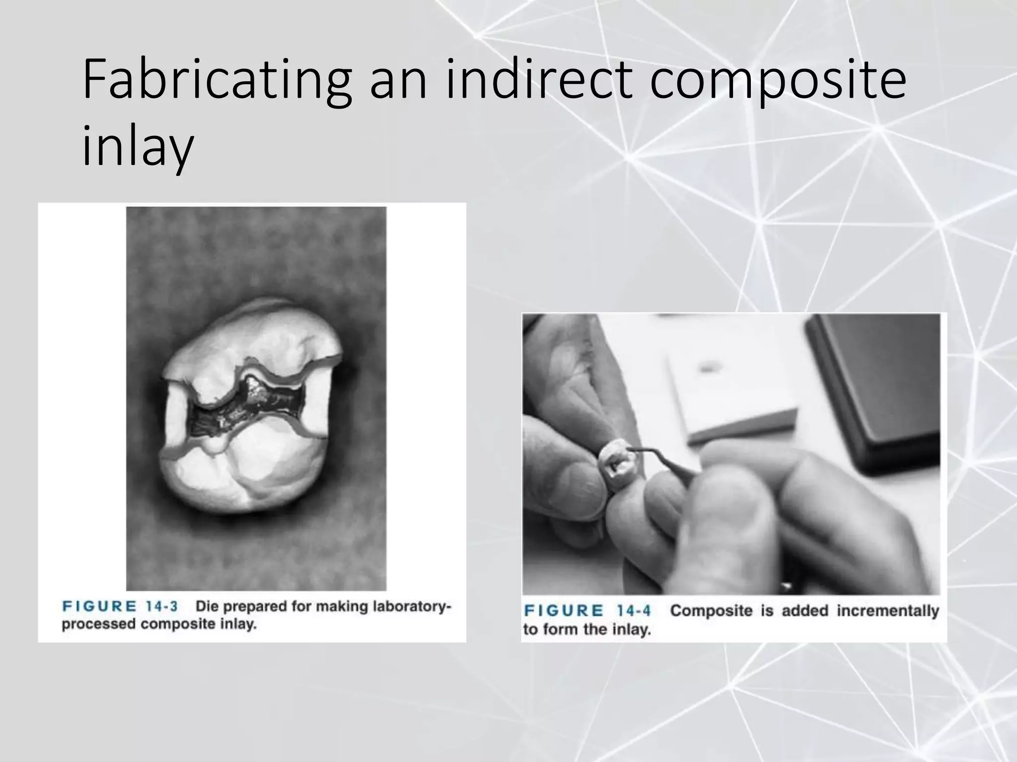 Indirect composite restorations | PPTX