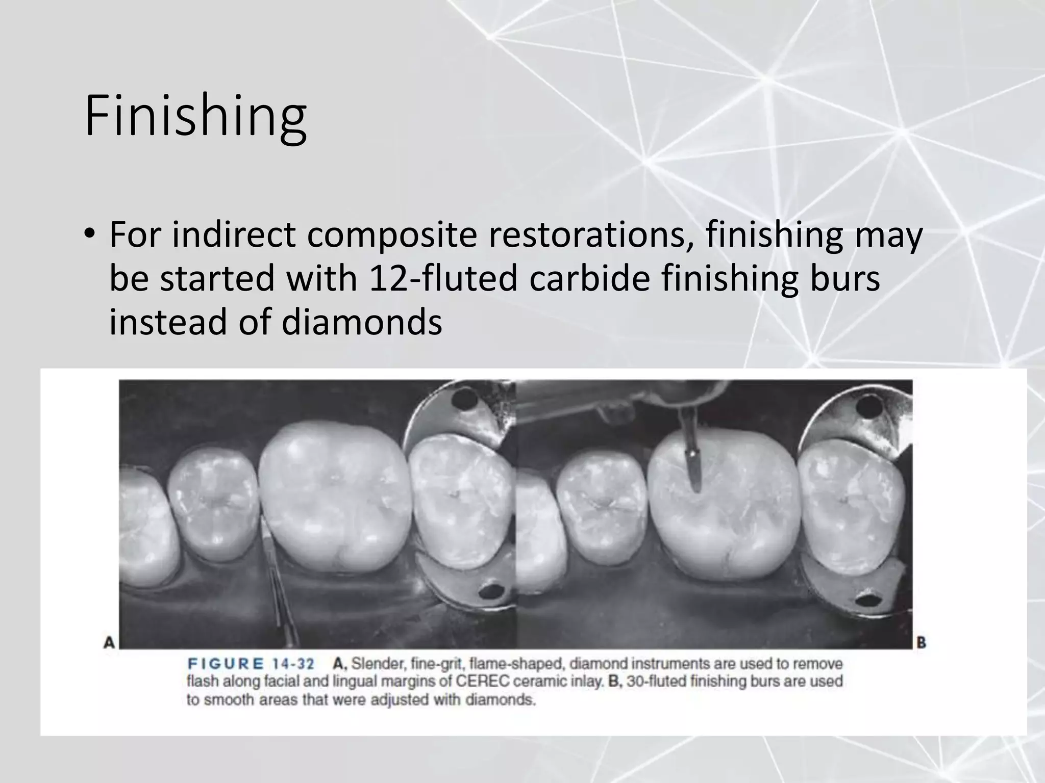 Indirect composite restorations | PPTX