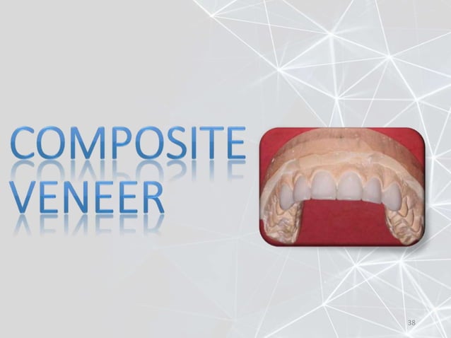 Indirect composite restorations | PPTX | Oral care | Personal Care