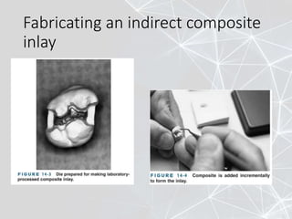Indirect composite restorations | PPTX