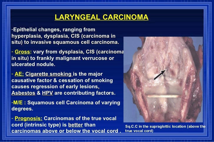 PATHOLOGY OF UPPER RESPIRARTORY