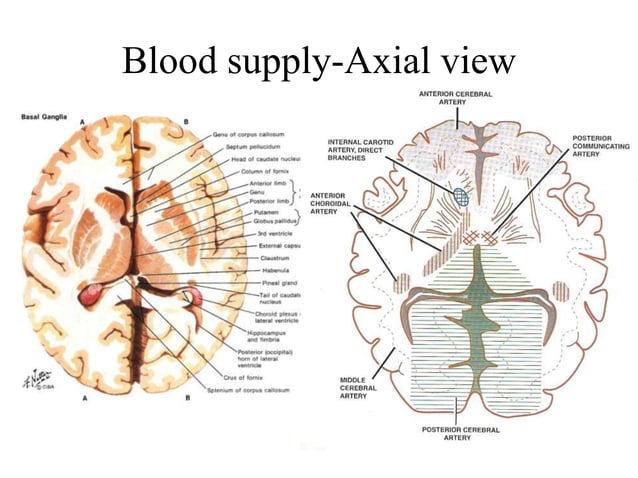 localization of stroke, CVS, stroke, for post graduates | PPT