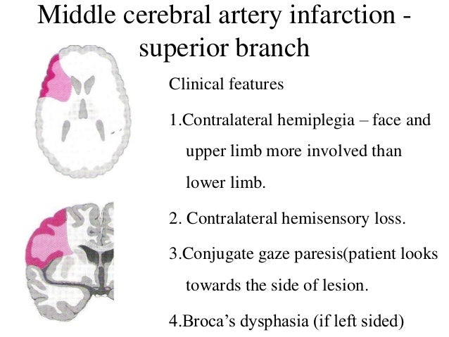 joinjoin彭醫師 說 http://www2.cmu.edu.tw/~cmcmd/ctanatomy/clinical ...