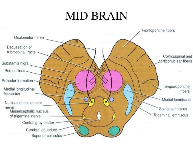 localization of stroke, CVS, stroke, for post graduates