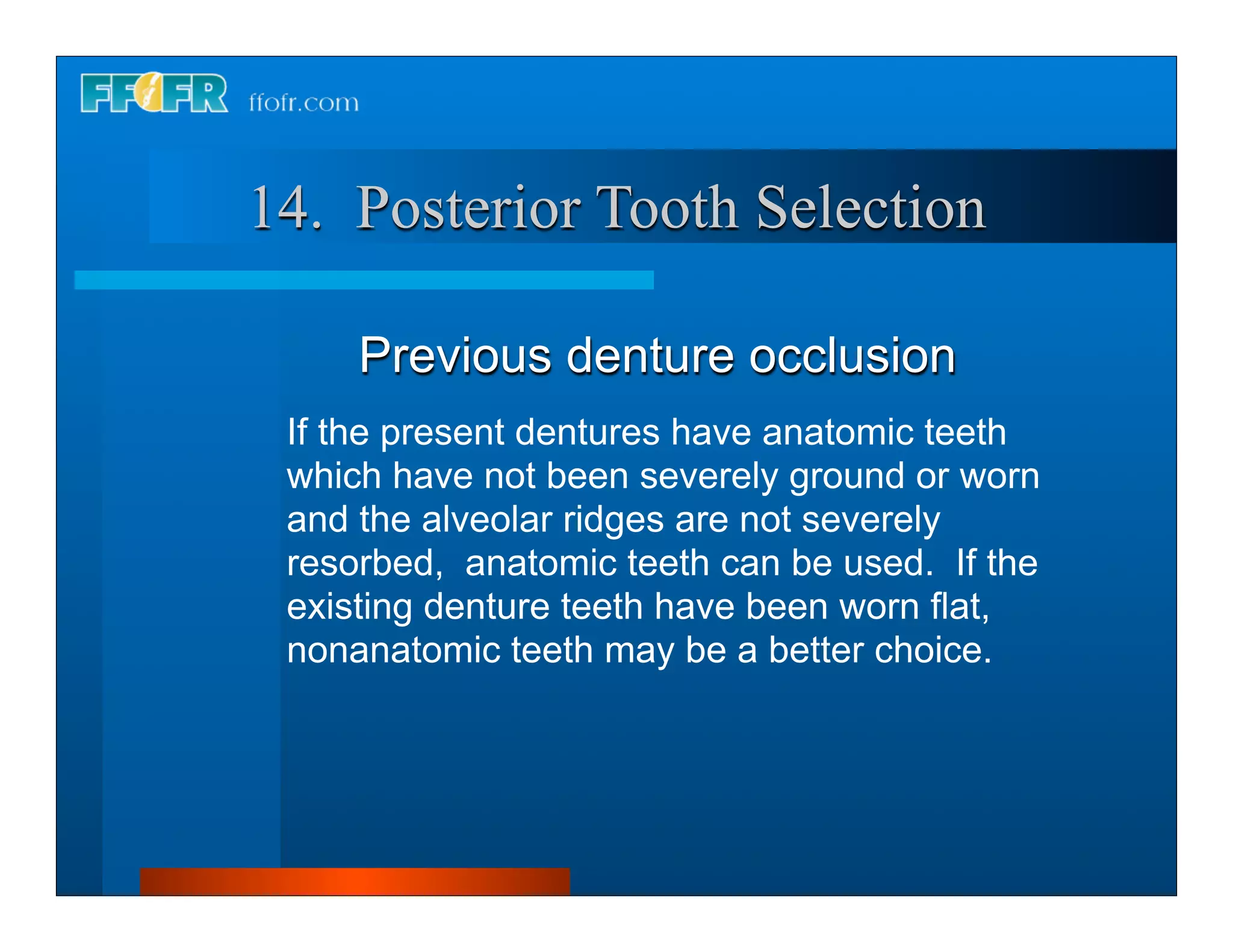 (New) 22.criteria for posterior tooth selection | PDF