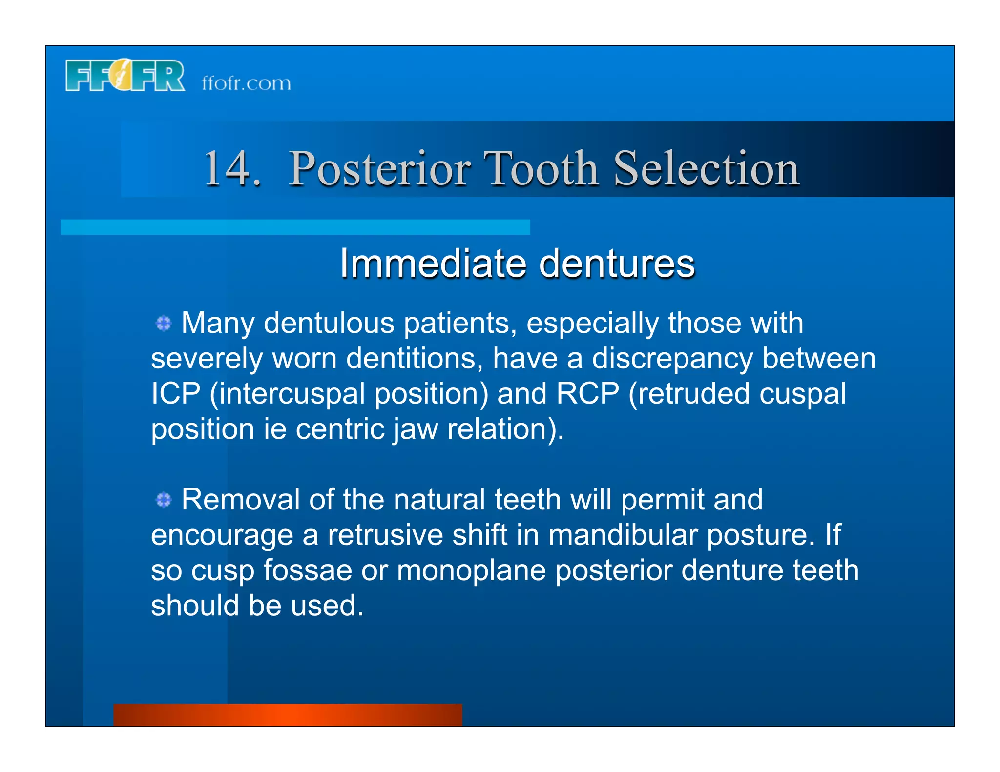 (New) 22.criteria for posterior tooth selection | PDF