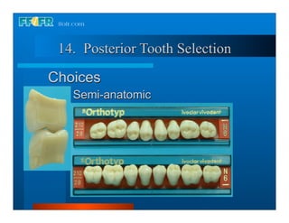 (New) 22.criteria for posterior tooth selection | PDF