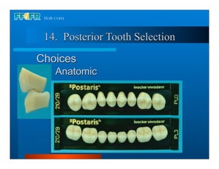 (New) 22.criteria for posterior tooth selection | PDF