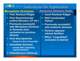 (New) 22.criteria for posterior tooth selection | PDF