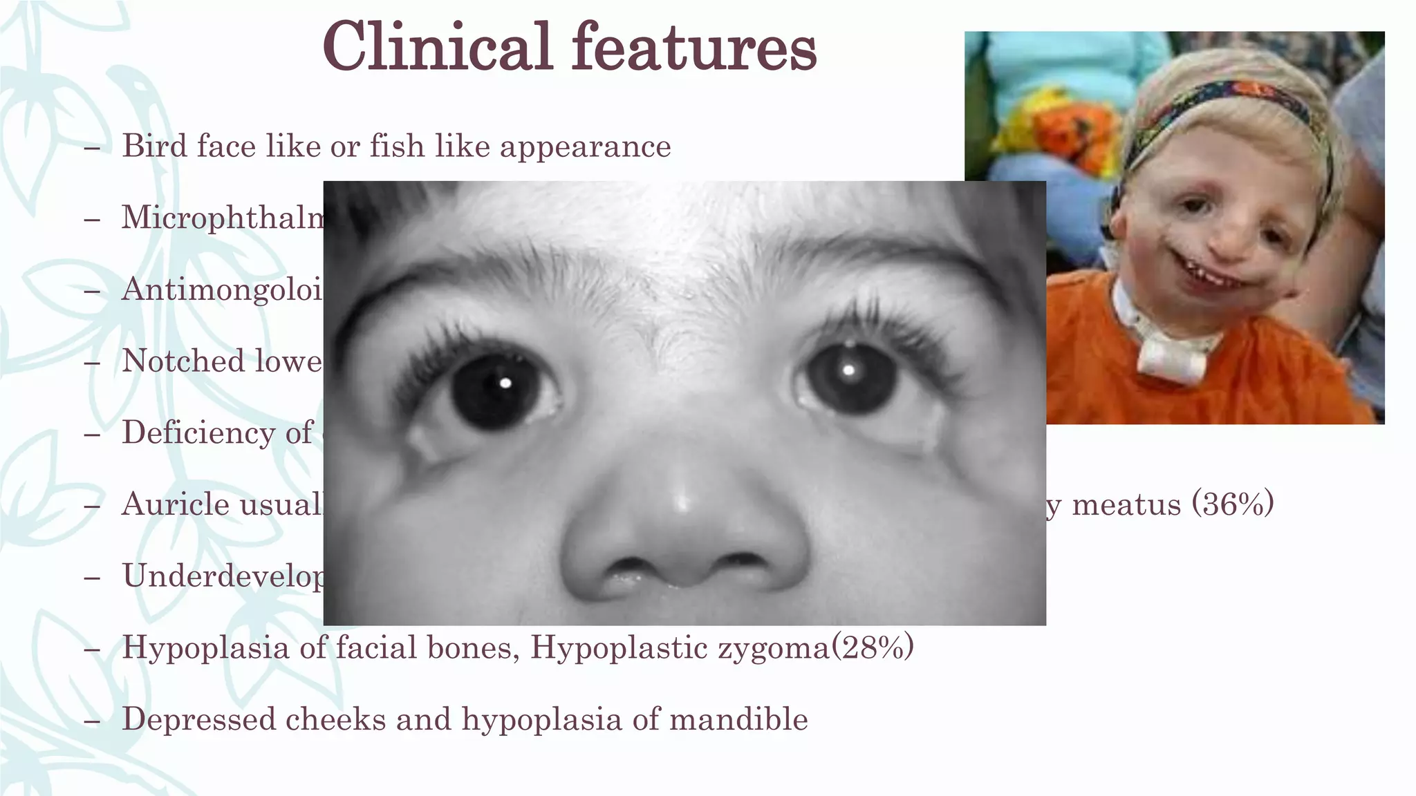 Genetic and chromosomal aberrations in children | PPTX