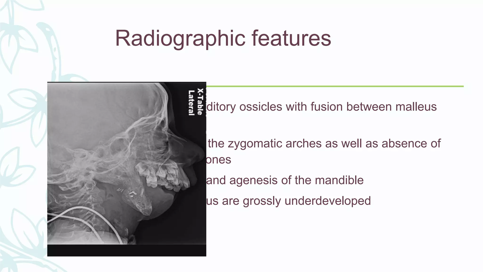 Genetic and chromosomal aberrations in children | PPTX