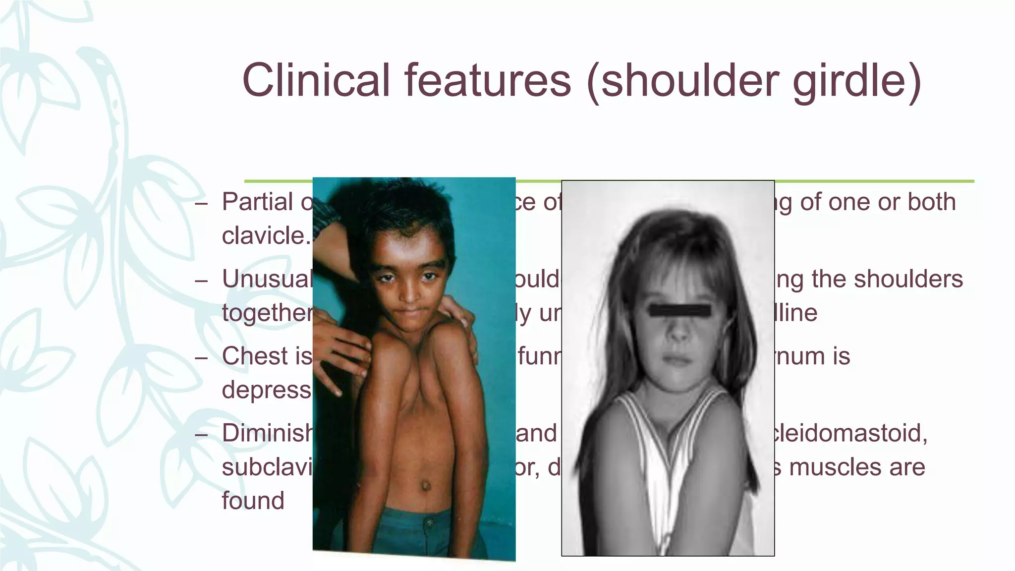 Genetic and chromosomal aberrations in children | PPTX