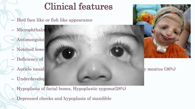 Genetic and chromosomal aberrations in children | PPTX | Reproductive ...