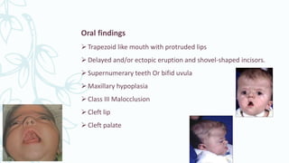 Genetic and chromosomal aberrations in children | PPTX