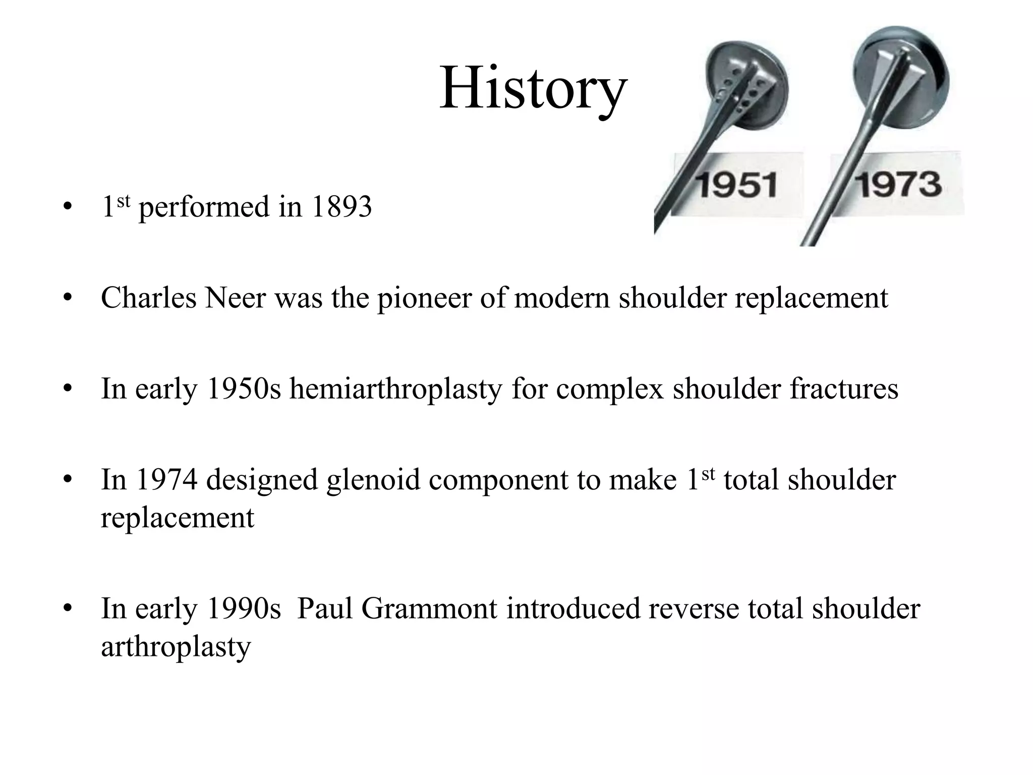 New advance shoulder arthroplasty | PPTX