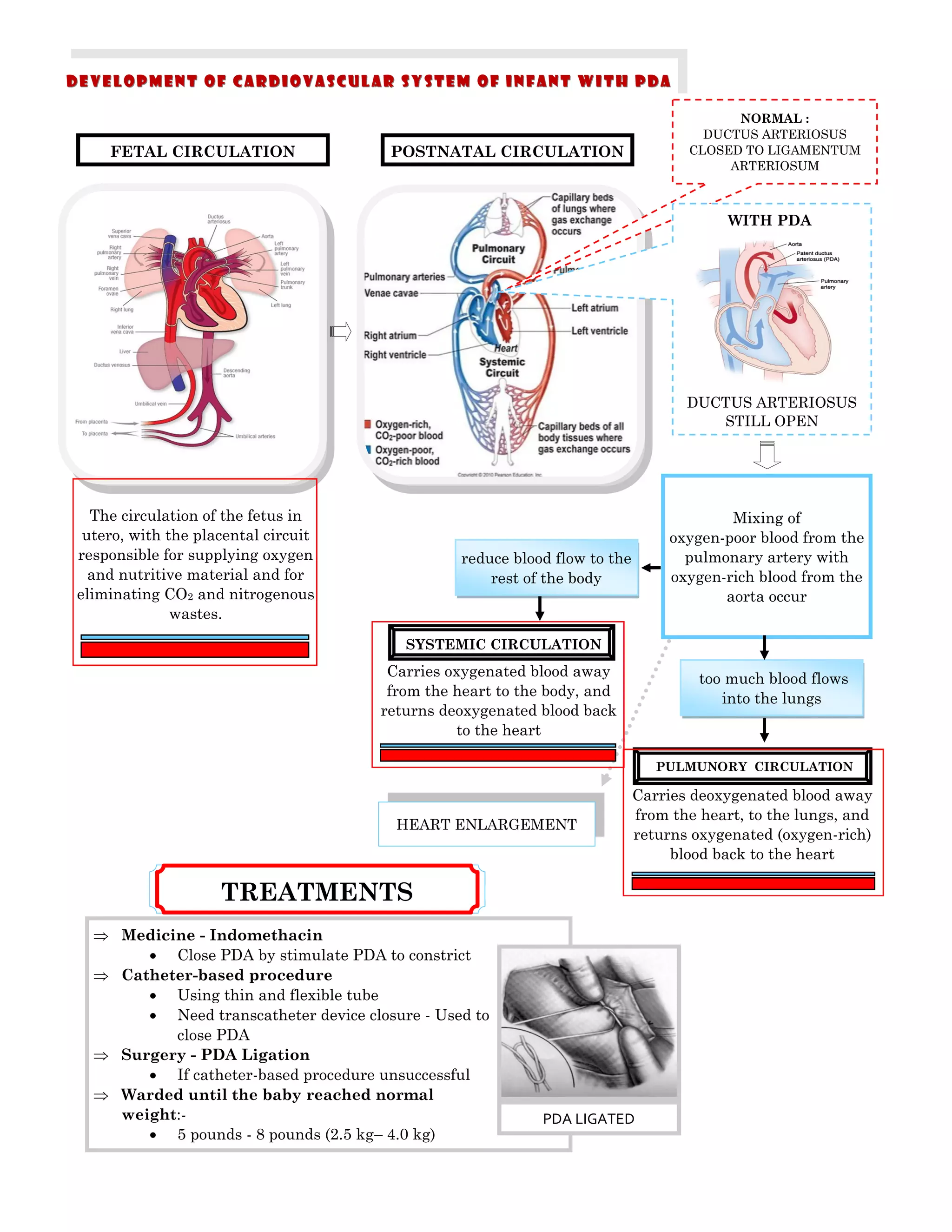 Patent Ductus Arteriosus | PDF