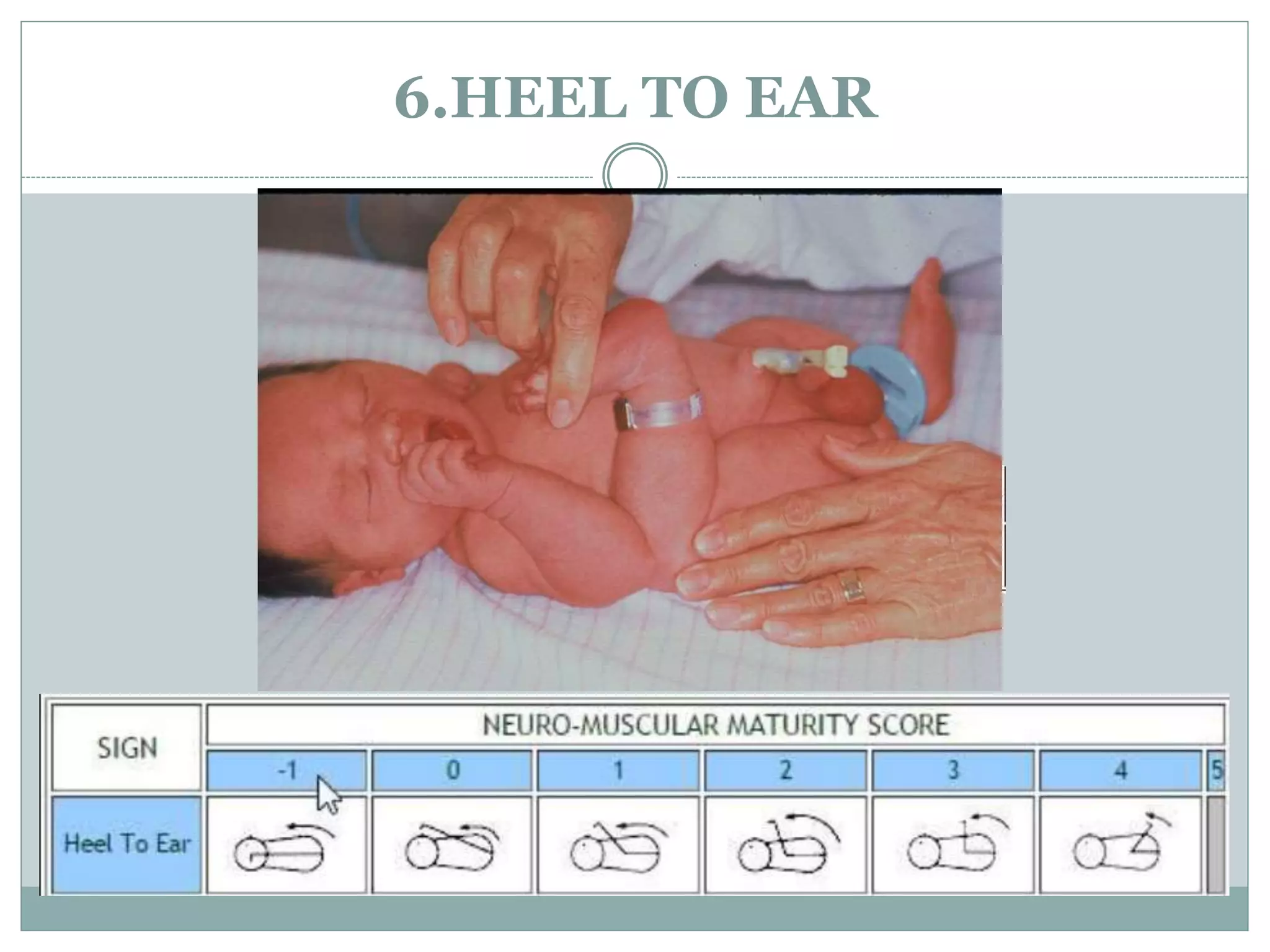 New ballard score | PPTX