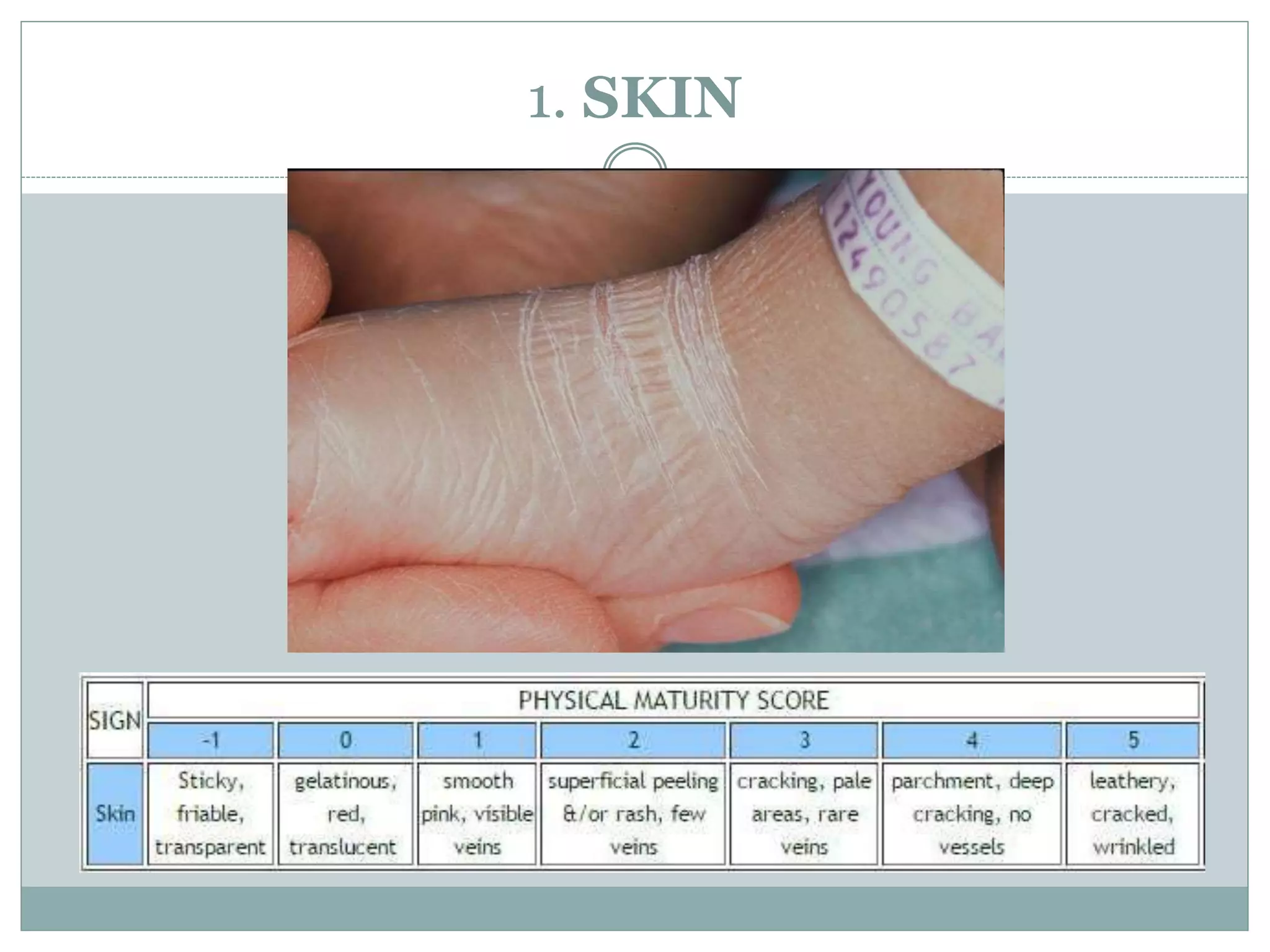 New ballard score | PPTX