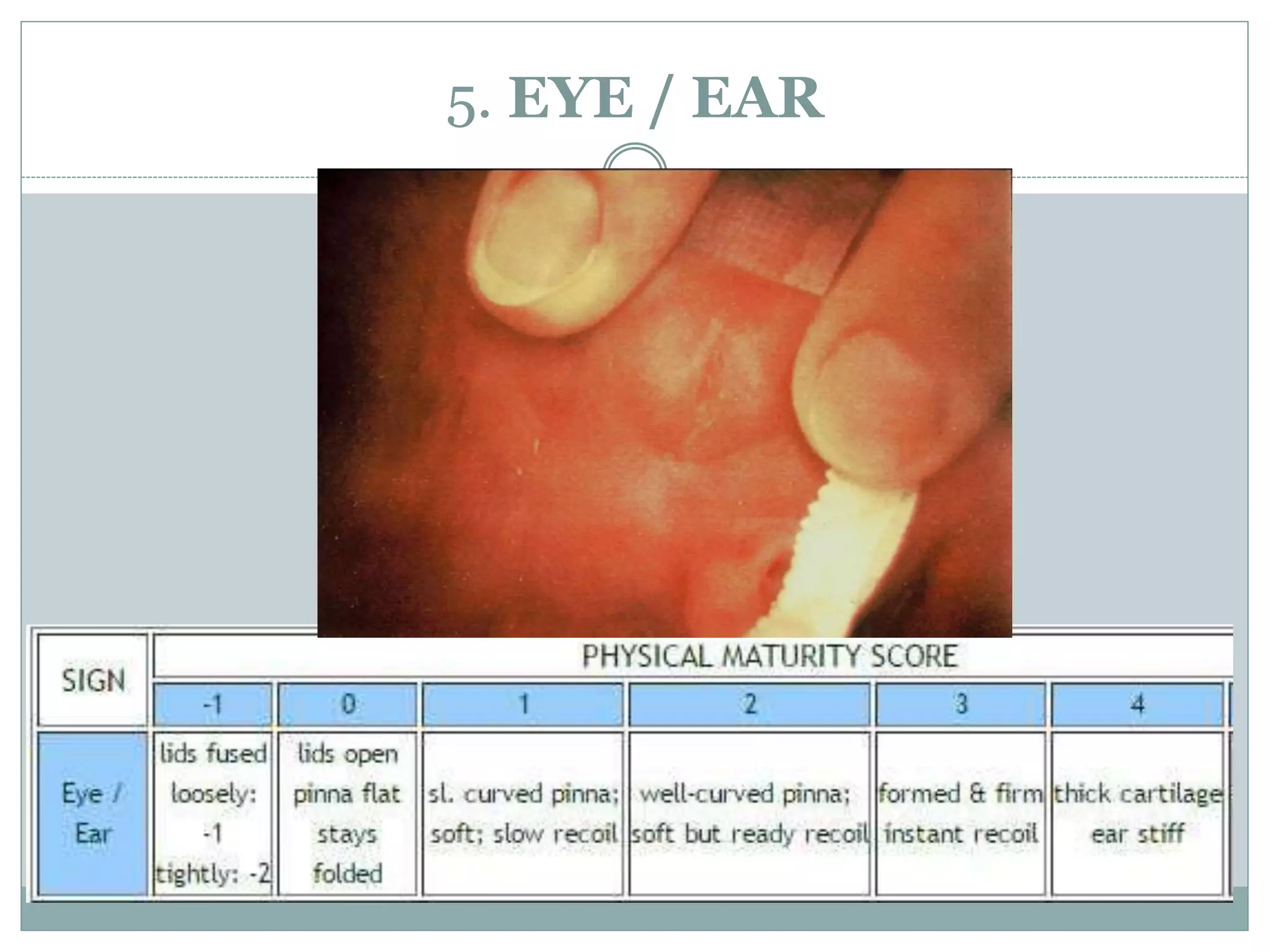 New ballard score | PPTX