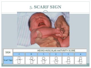 New ballard score | PPTX