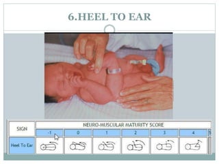 New ballard score | PPTX