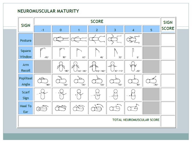 New ballard score | PPTX