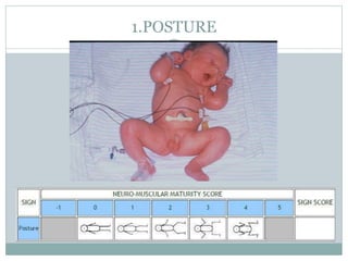 New ballard score | PPTX