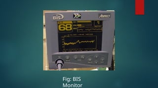 BIS Monitoring and It's Role in Anesthesia - Jeet Dey.pptx