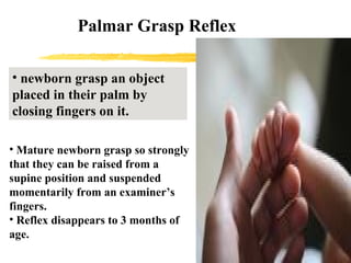 Newborn | PPT