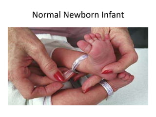 Newborn | PPT