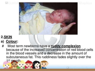 Ruddy Complexion Baby