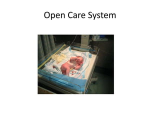 Apnea in newborns, Hypothermia and Hyperthermia | PPT