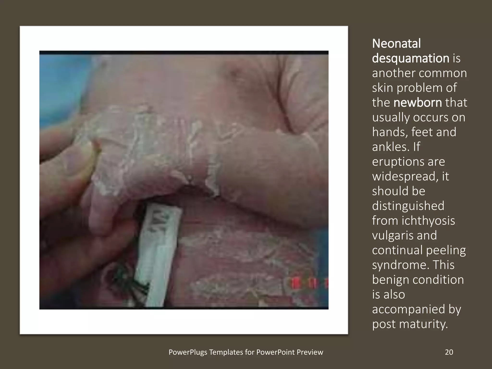 Newborn-Assessment.pptx