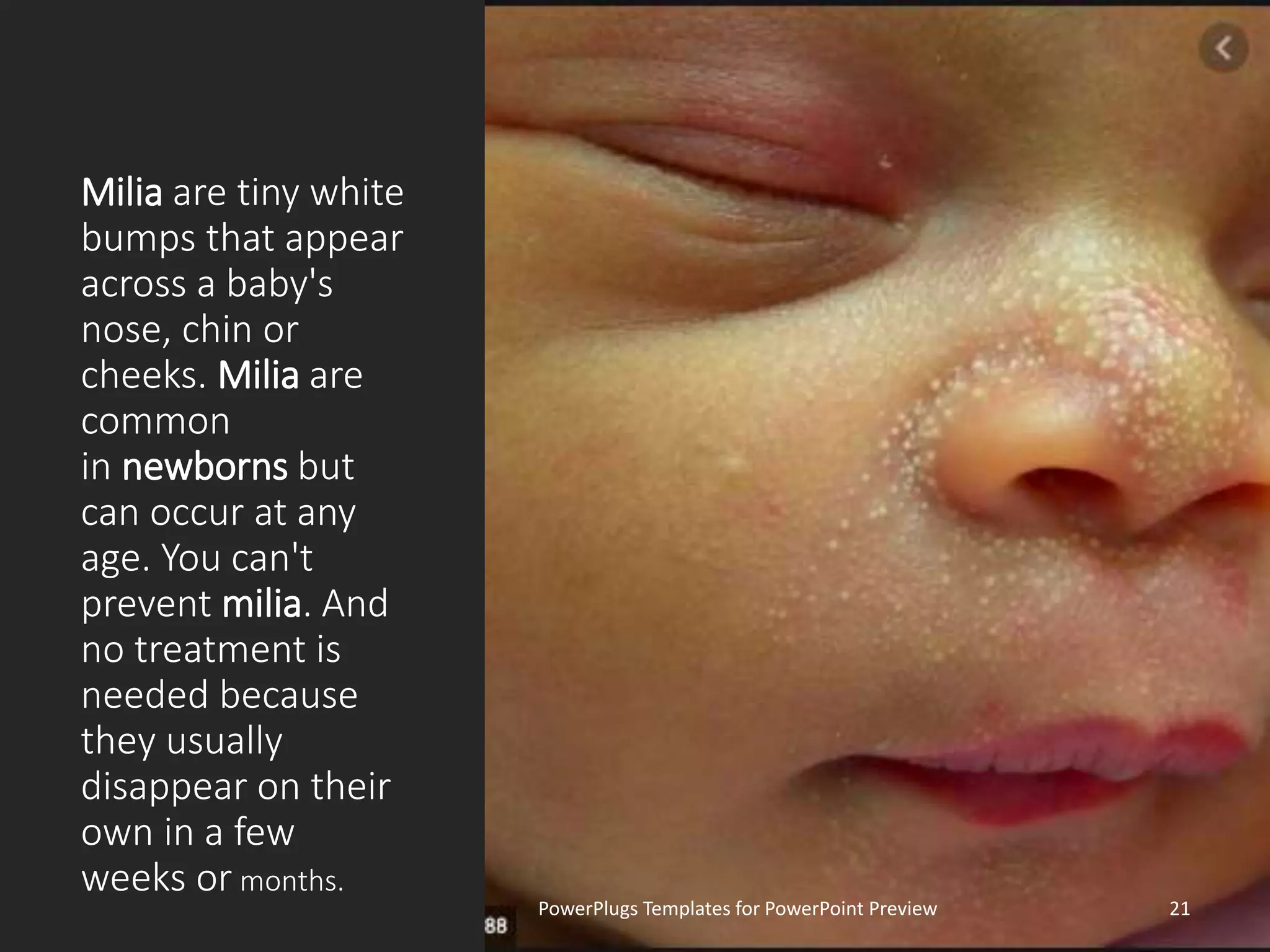 Newborn-Assessment.pptx
