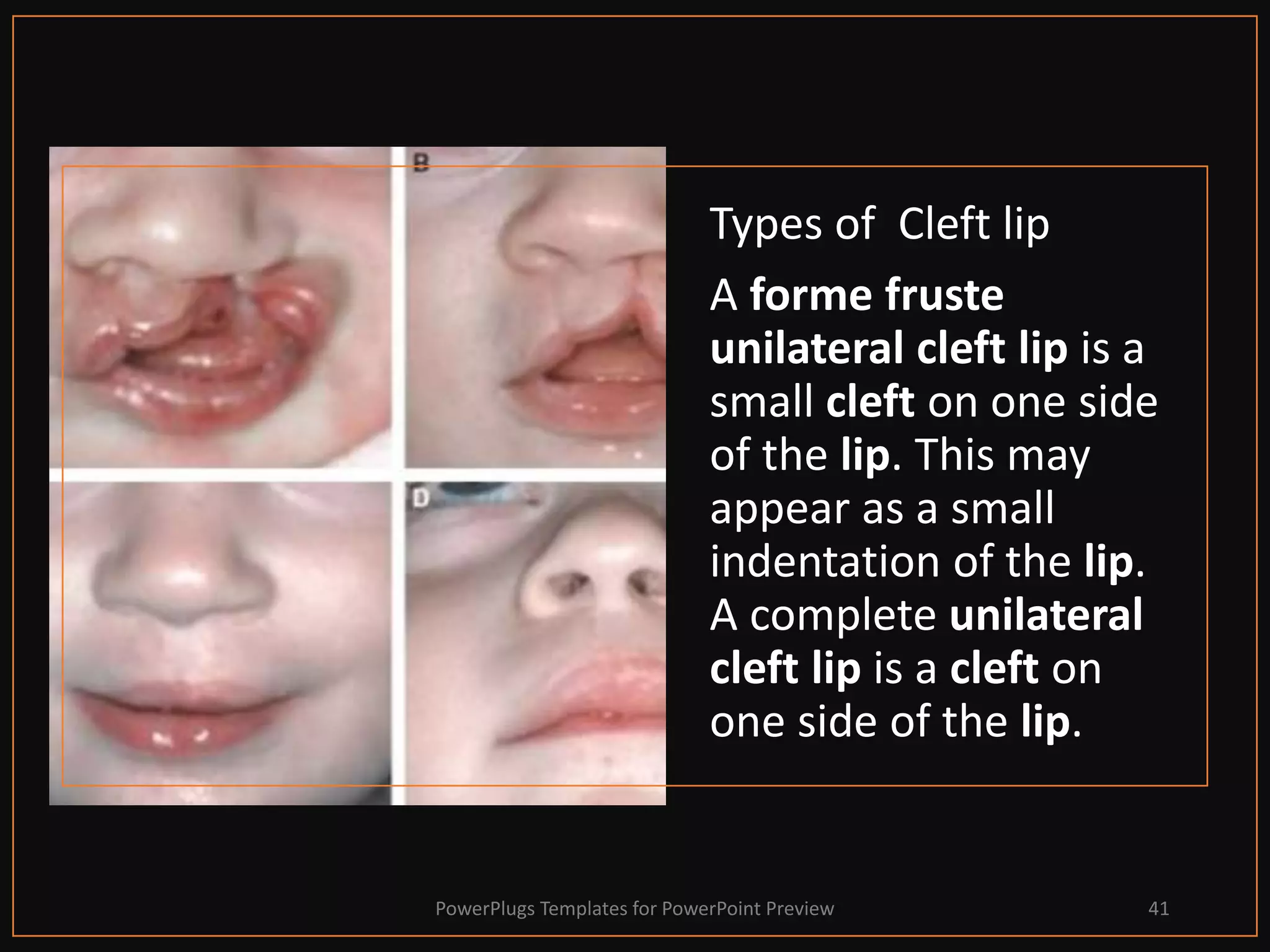 Newborn-Assessment.pptx