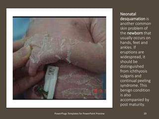 Newborn-Assessment.pptx