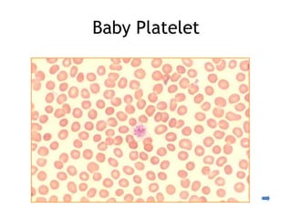 Bleeding in newborns | PPTX