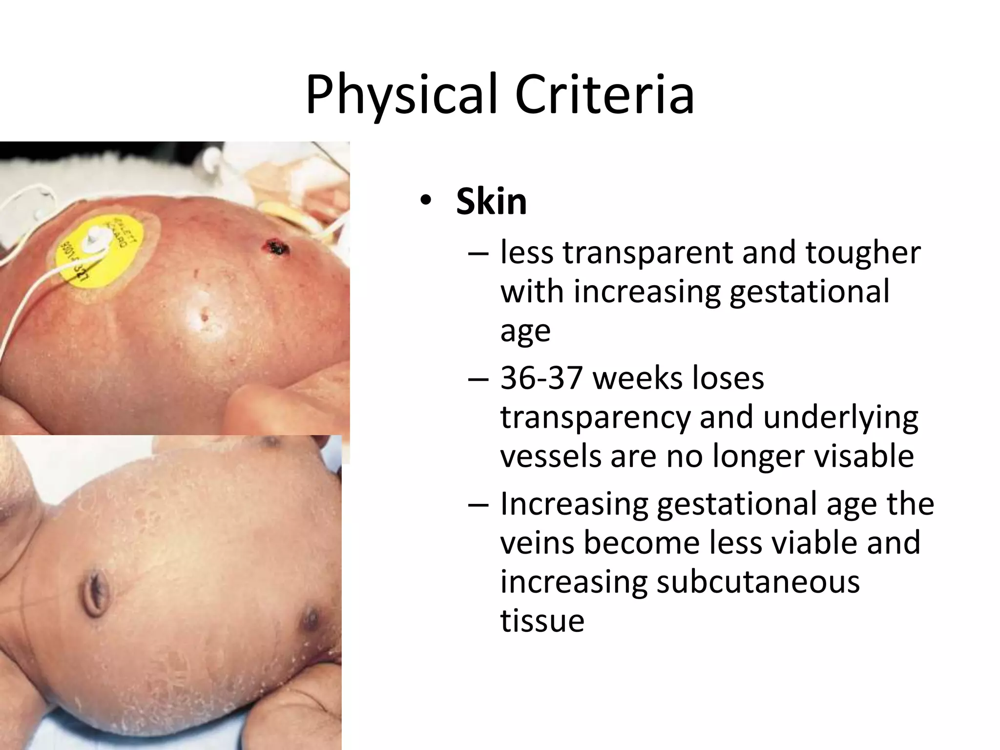 Gestational age assessment and Neonatal reflexes | PPTX