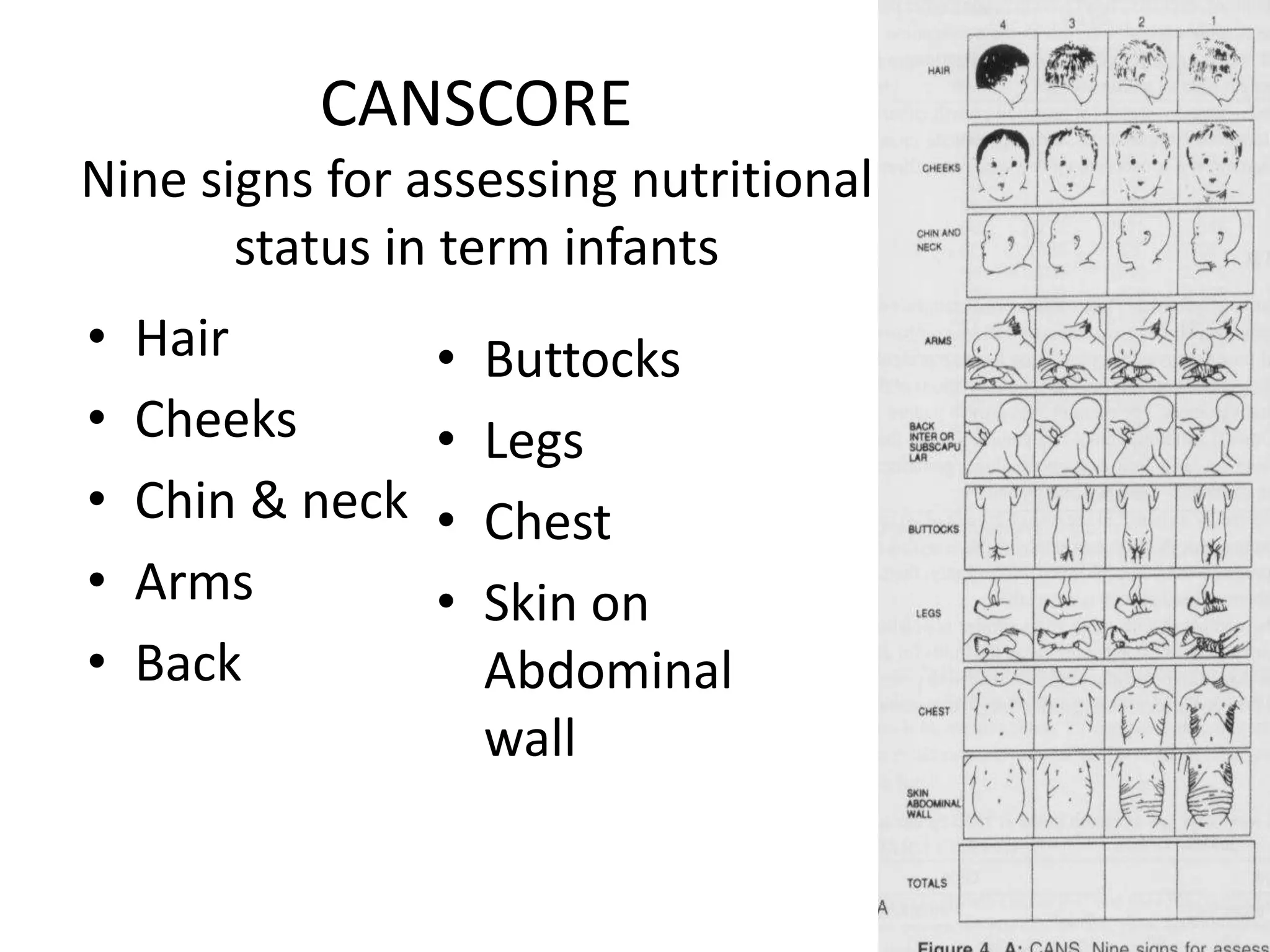 Gestational age assessment and Neonatal reflexes | PPTX