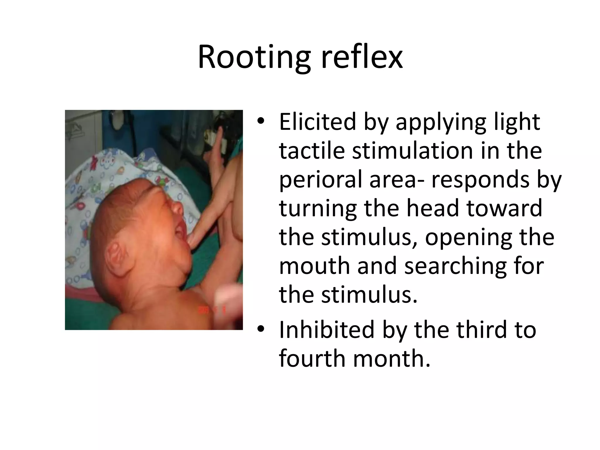 Gestational age assessment and Neonatal reflexes | PPTX
