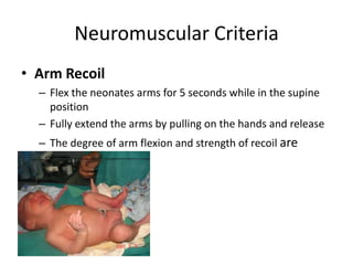 Gestational age assessment and Neonatal reflexes | PPTX