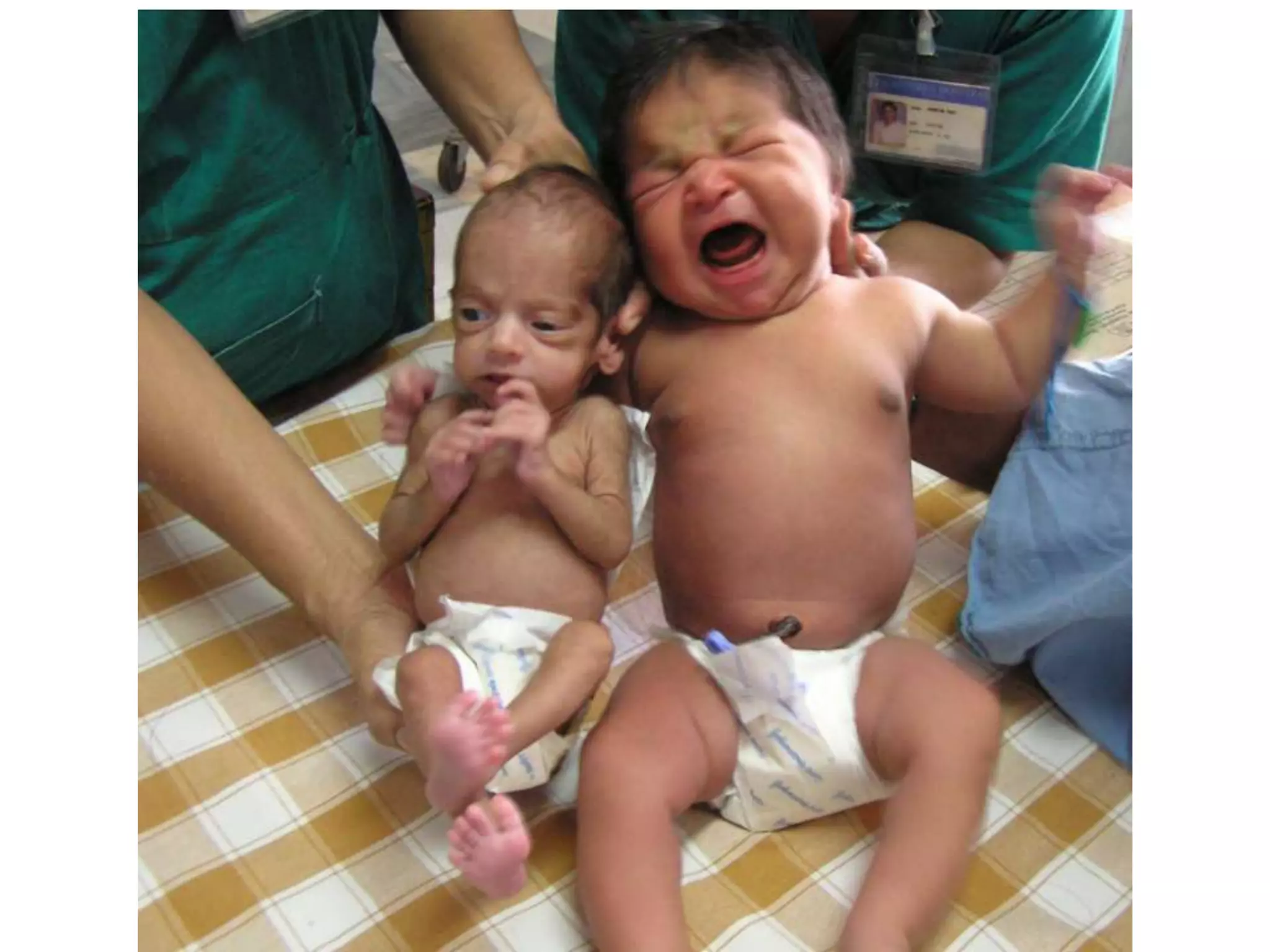 Prematurity and IUGR | PPTX