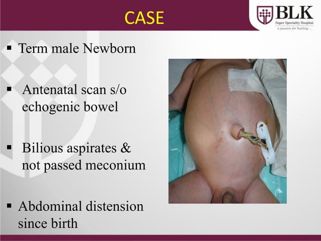 Newborn surgical-emergencies | PDF