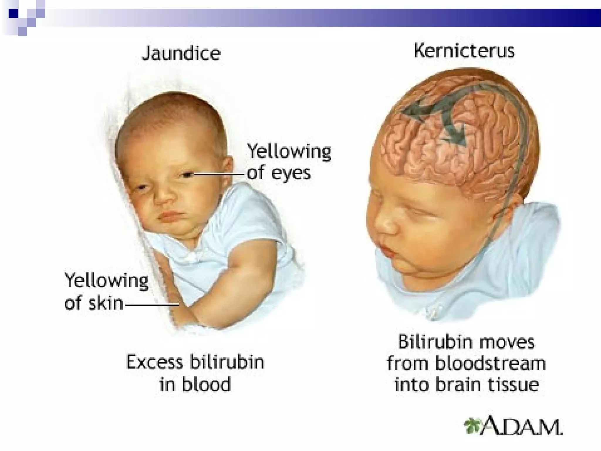 Newborn adaptation | PPT