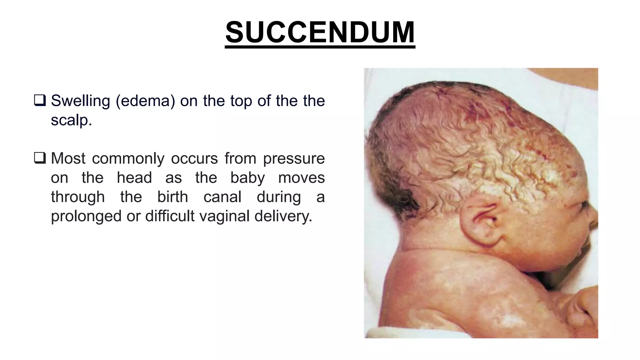 NEW BORN ASSESEMENT updated.pptx