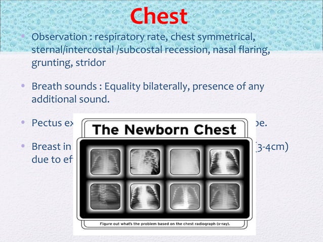 Newborn assessment | PPT