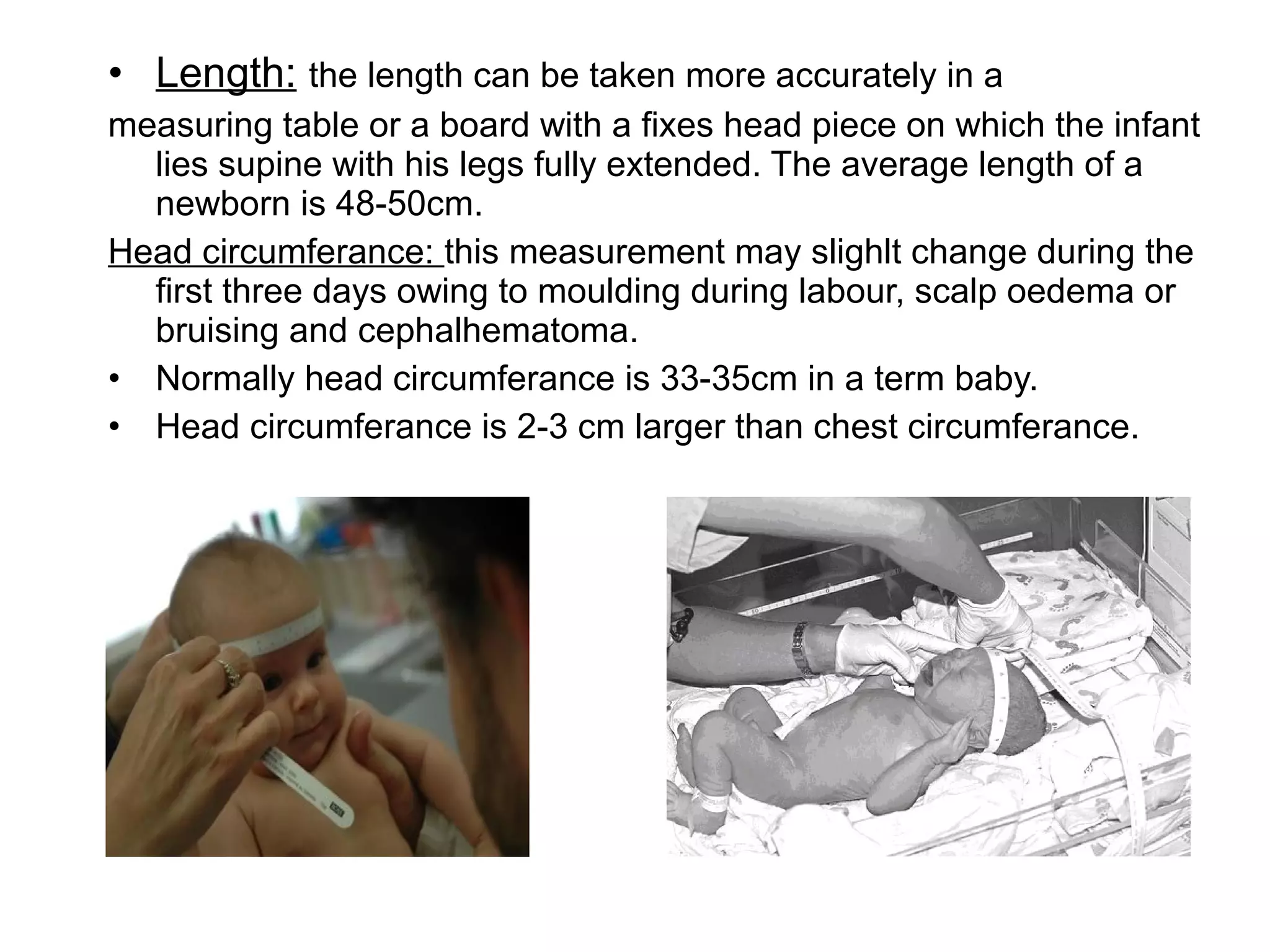 Newborn assessment | PPT